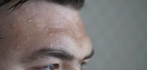 Understanding Alcohol Sweats | Resource Hub | Providence Projects